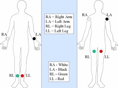Medicine Decoded: Ecg leads